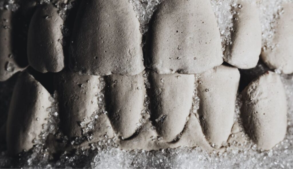 How Does Sugar Affect Your Teeth? - Kaufman Dentistry