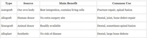 What is Bone Grafting? - Kaufman Dentistry